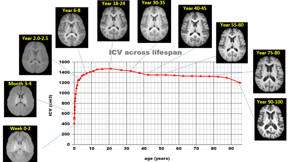 Brain Atlases | Image, Informatics & Intelligence (i3) Research Lab