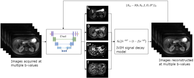 Self-supervised IVIM parameter estimation with a physics based forward model (Vasylechko et al ...